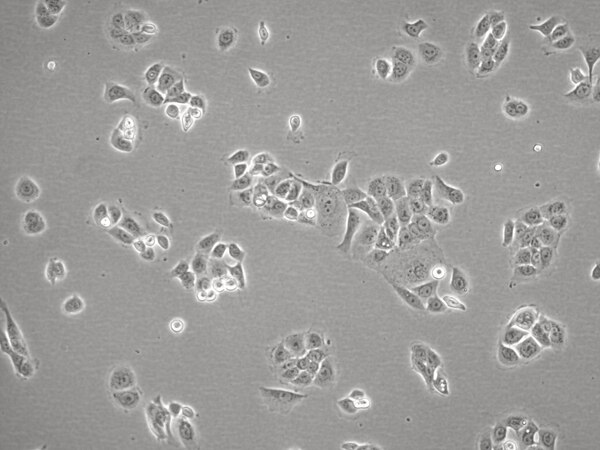 OVCAR-5 Human Cancer Cell Line | SCC259